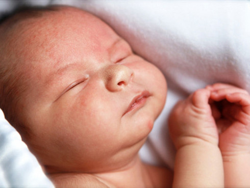 Manchas en la piel de bebés recién nacidos | El Blog del Bebé
