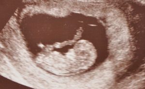 Semana 10 de Embarazo; ¡El Bebé Comienza a Moverse! ️