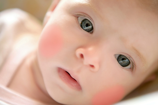 Granos en la Cara en Bebés y Niños ⇒ 【Tratamiento】 ️